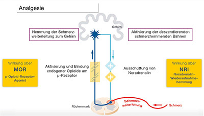 Schmerzleitung - arztCME